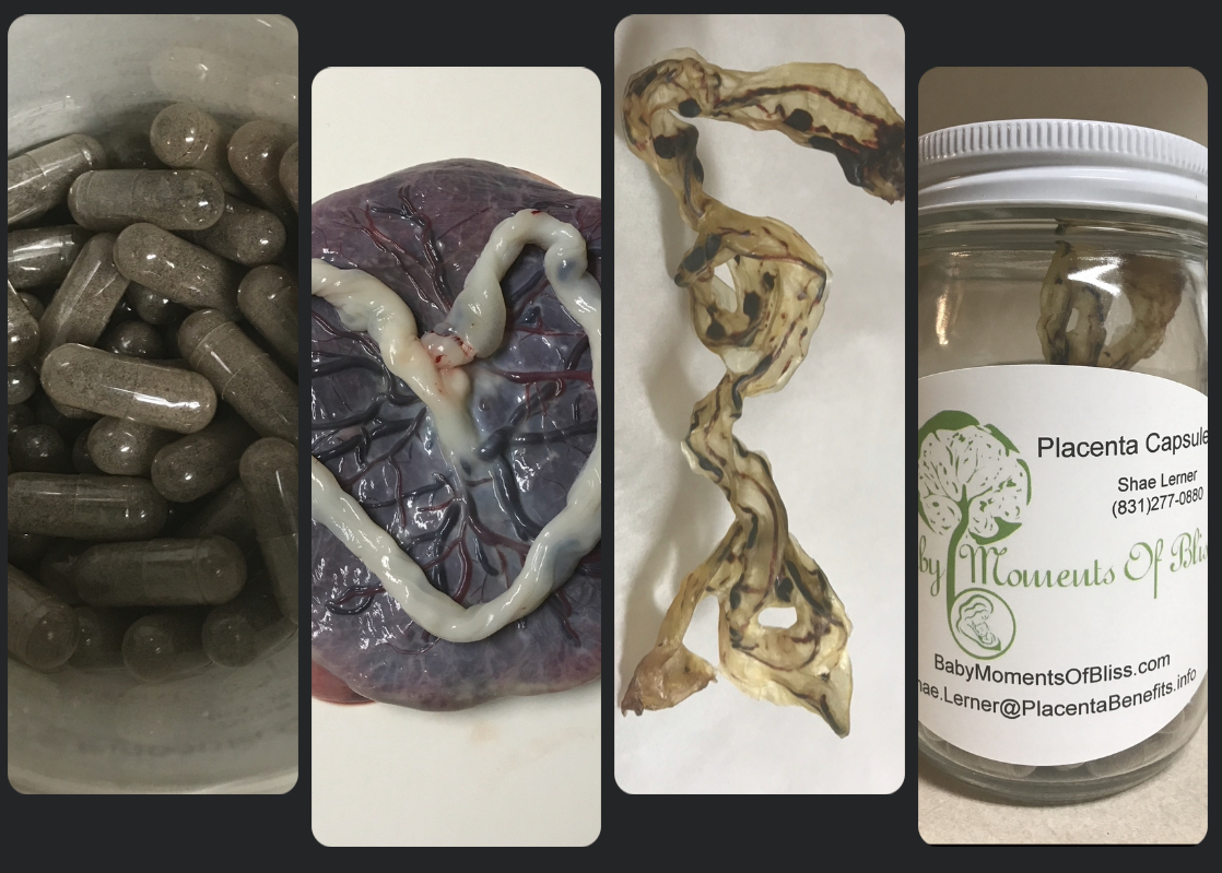 Placenta Encapsulation Services